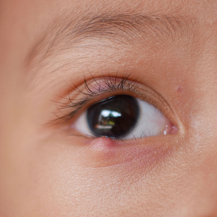 Stye Treatment with Eye-Press: Patented Self-Heating Compress for Dry ...